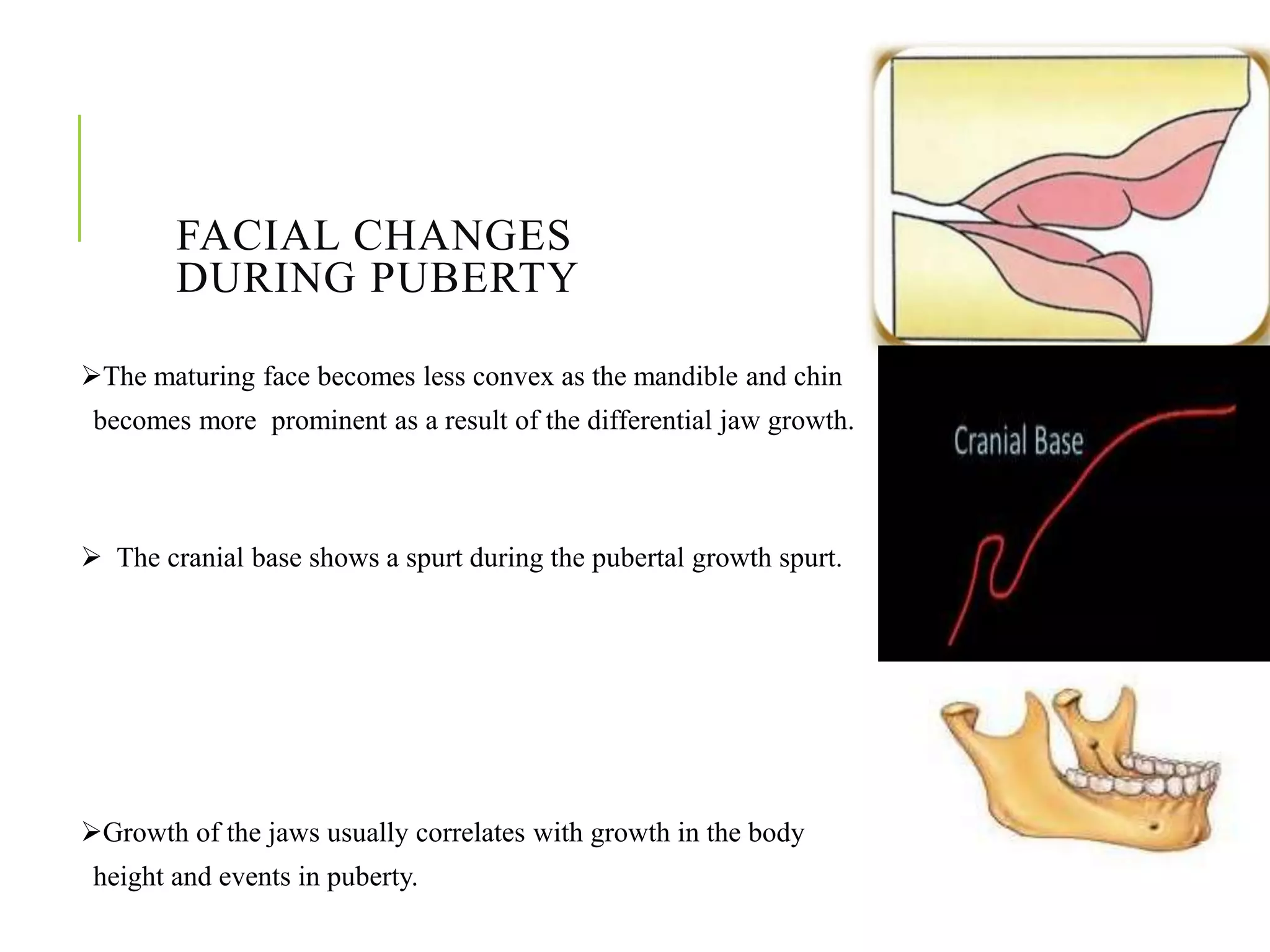 Craniofacial growth during adolescence | PPTX