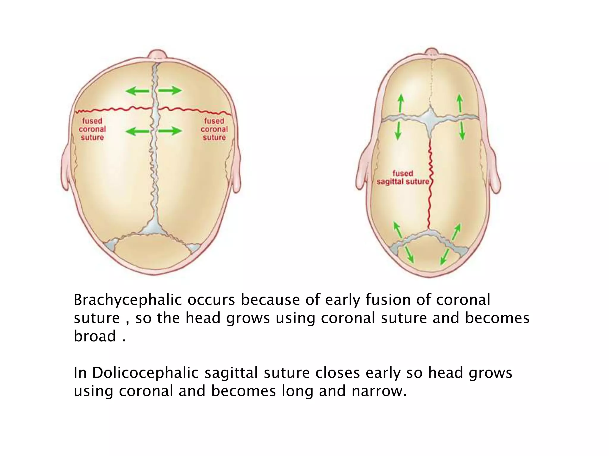 Craniofacial growth during adolescence | PPTX