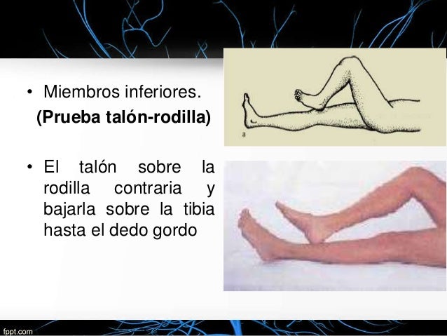 Motilidad y sensibilidad
