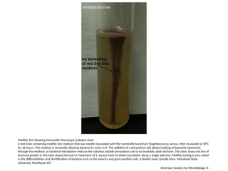 motility-test-medium.The tube on the left, inoculated with the motile ...
