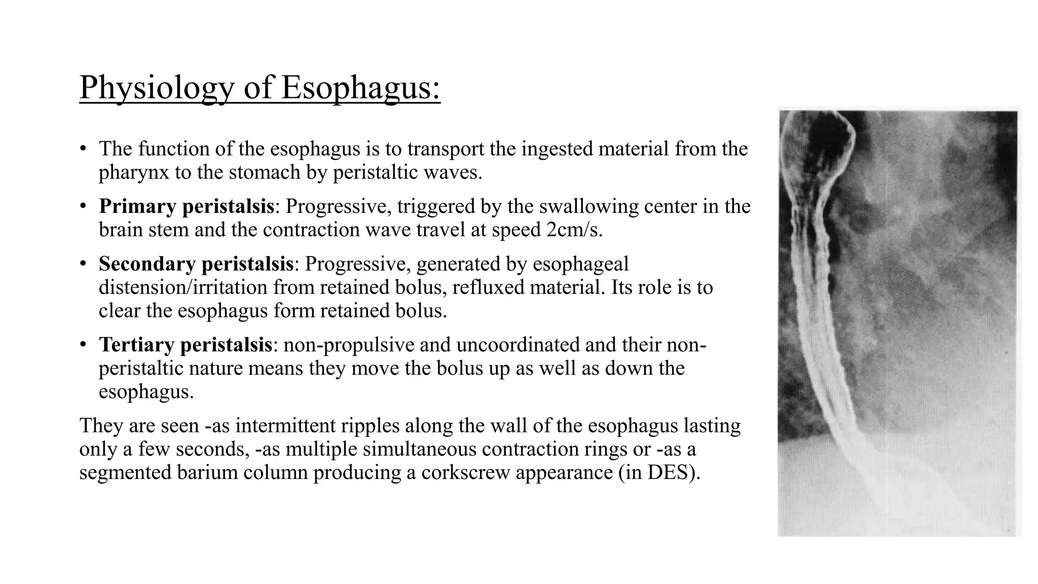 Motility disorders of esophagus new | PPTX | Digestive Disorders ...