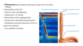 Motility disorders of esophagus new | PPTX