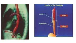 Motility disorders of esophagus new | PPTX | Digestive Disorders ...