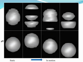Motion management in Radiation Oncology - 2020 | PPTX
