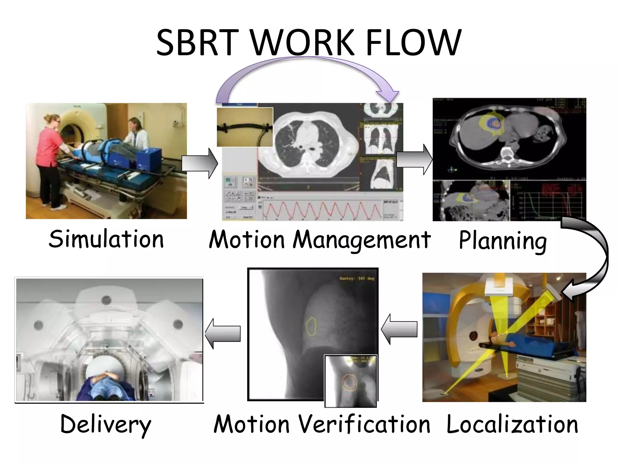 MOTION MANAGEMENT IN RADIOTHERAPY | PPTX