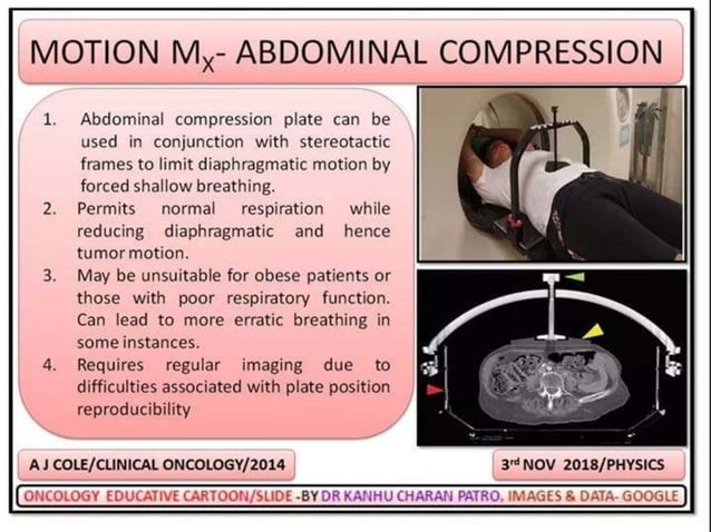 MOTION MANAGEMENT IN RADIOTHERAPY | PPTX | Lung and Respiratory Health ...