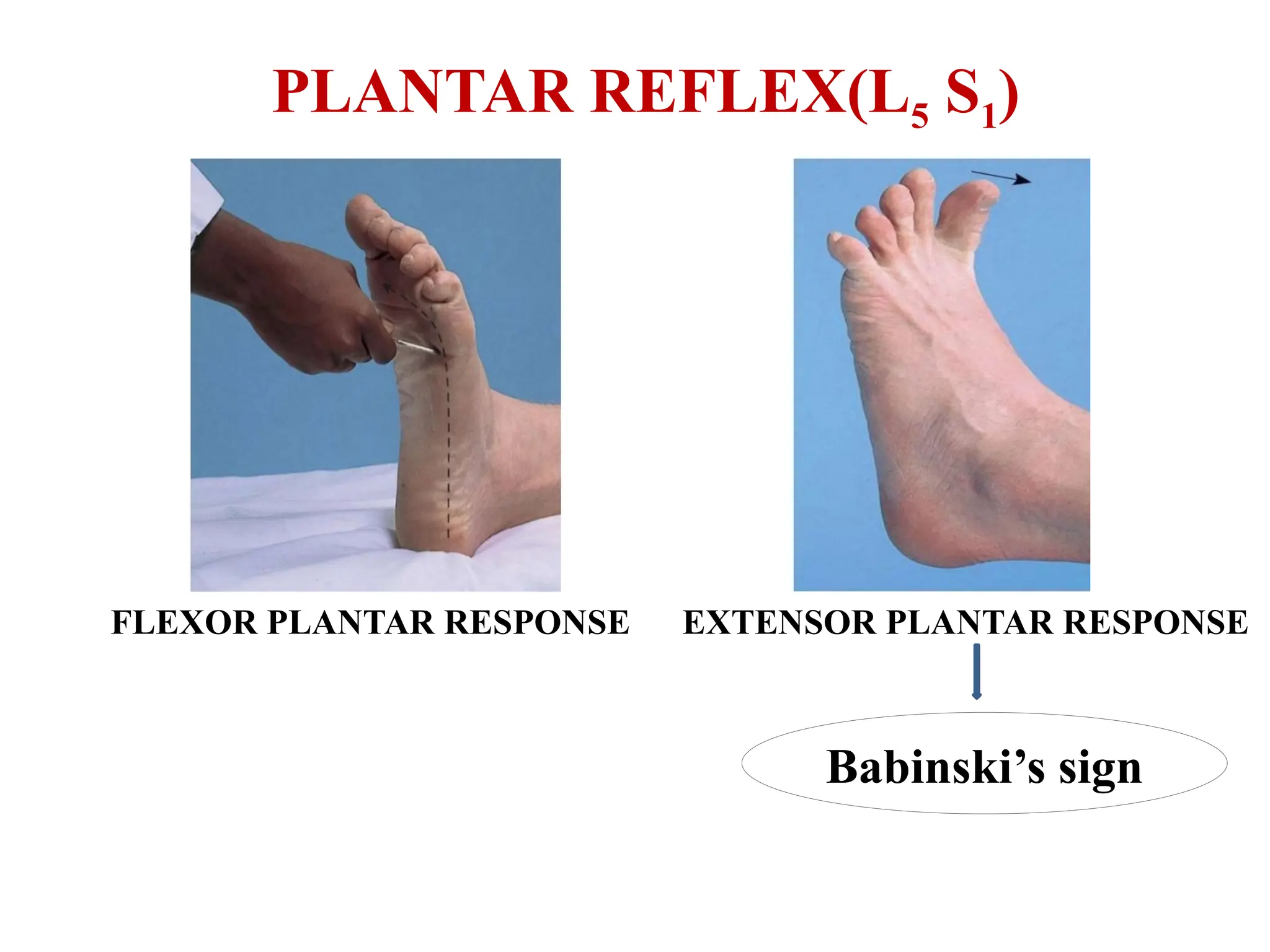 motor system and clinical examination of the same | PPTX