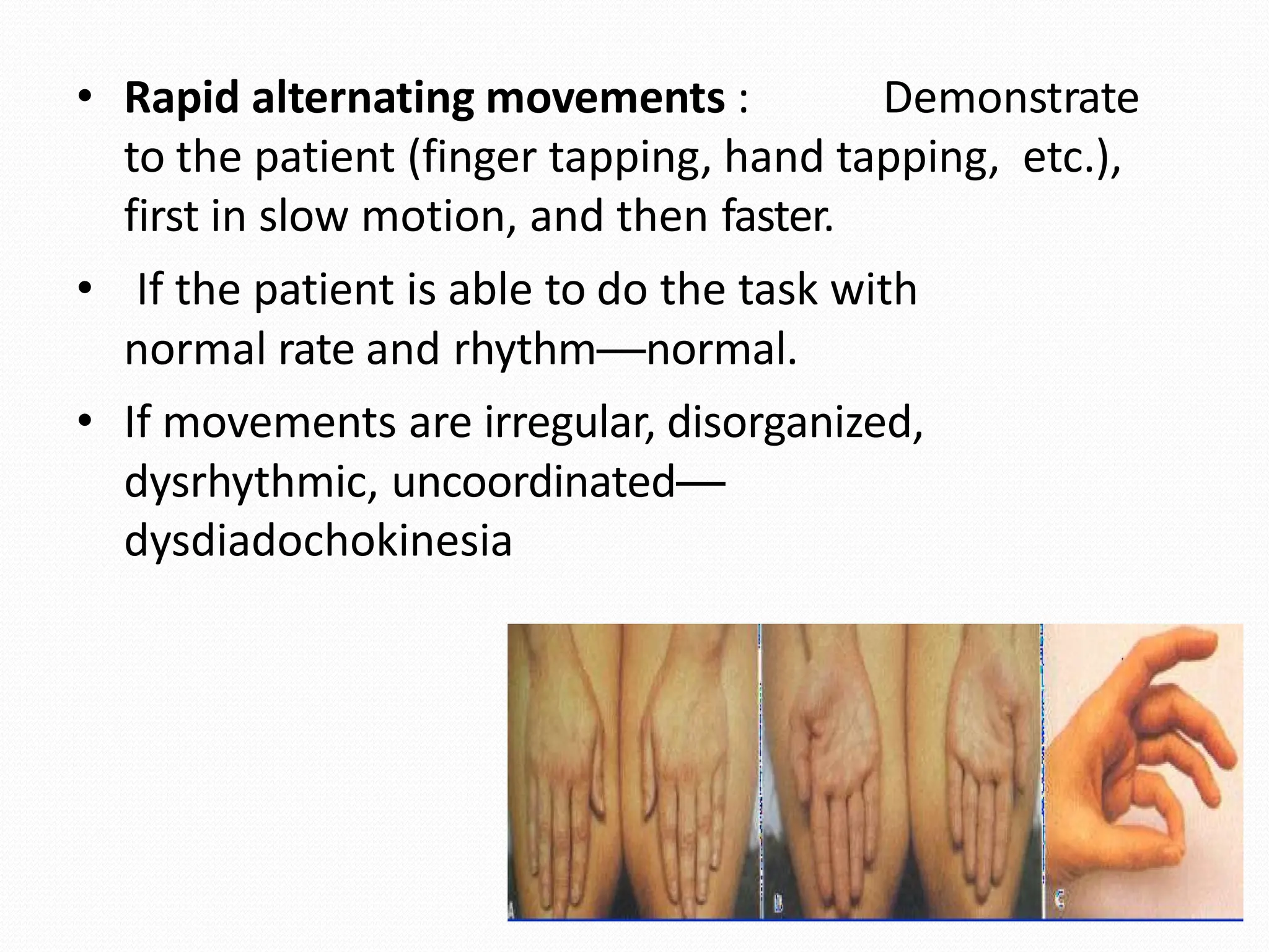 MOTOR SYSTEM , ASSESSING HEALTH ASSESSMENT | PDF