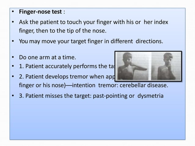 MOTOR SYSTEM , ASSESSING HEALTH ASSESSMENT | PPT