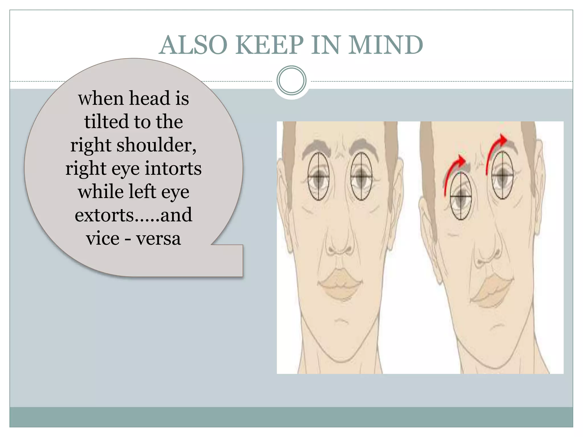 Motor adaptation in paretic and nonparetic strabismus | PPTX