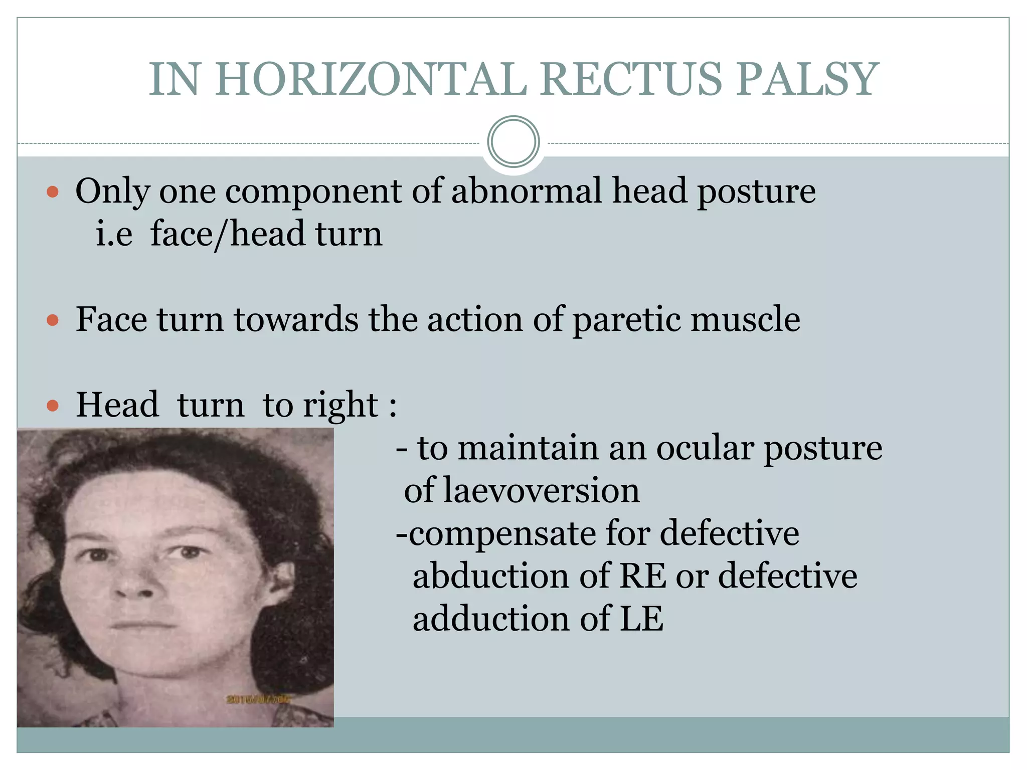 Motor adaptation in paretic and nonparetic strabismus | PPTX
