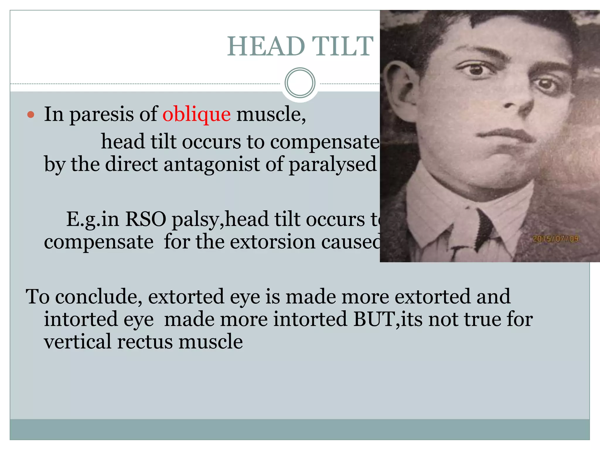 Motor adaptation in paretic and nonparetic strabismus | PPTX
