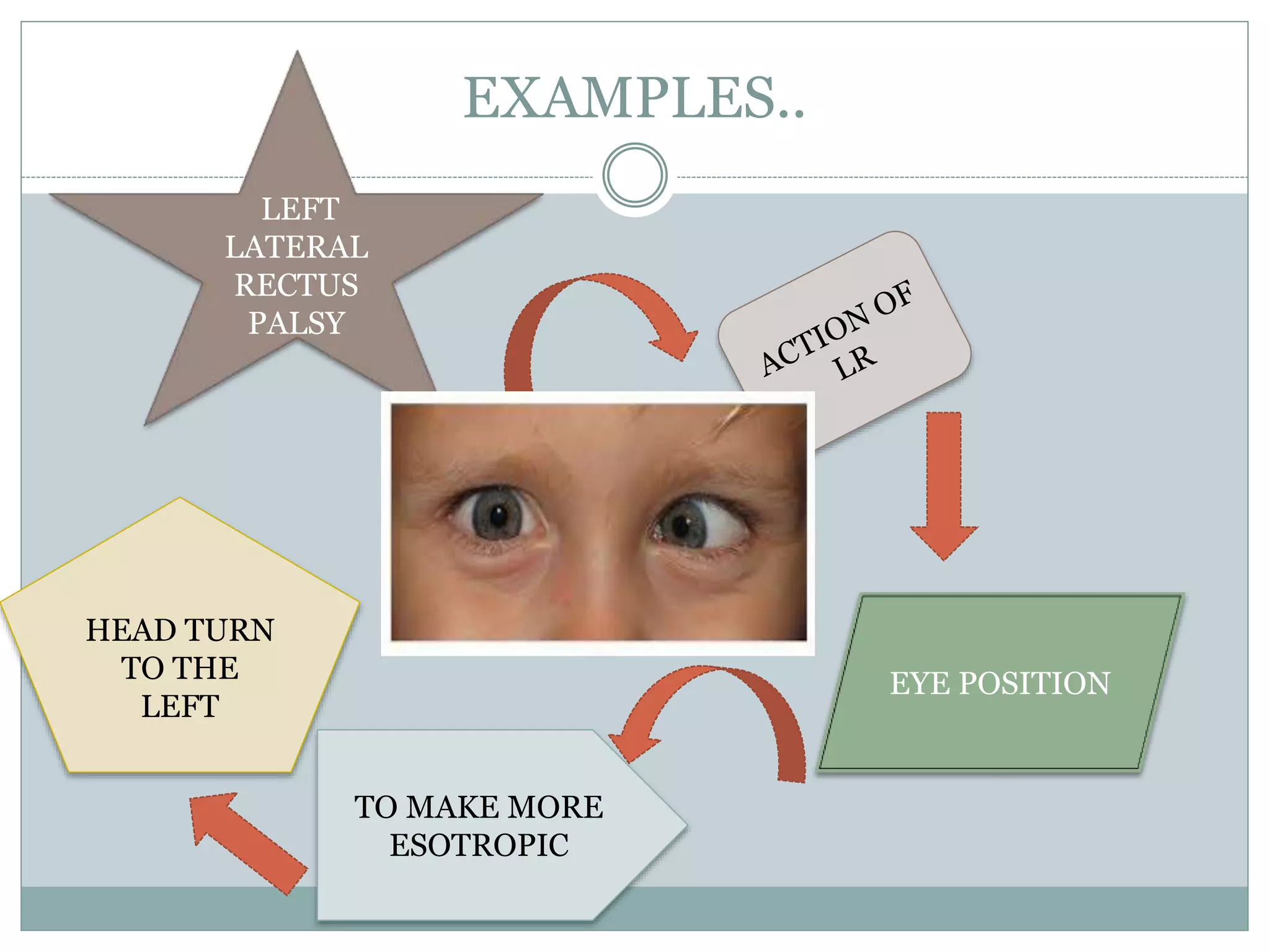 Motor adaptation in paretic and nonparetic strabismus | PPTX