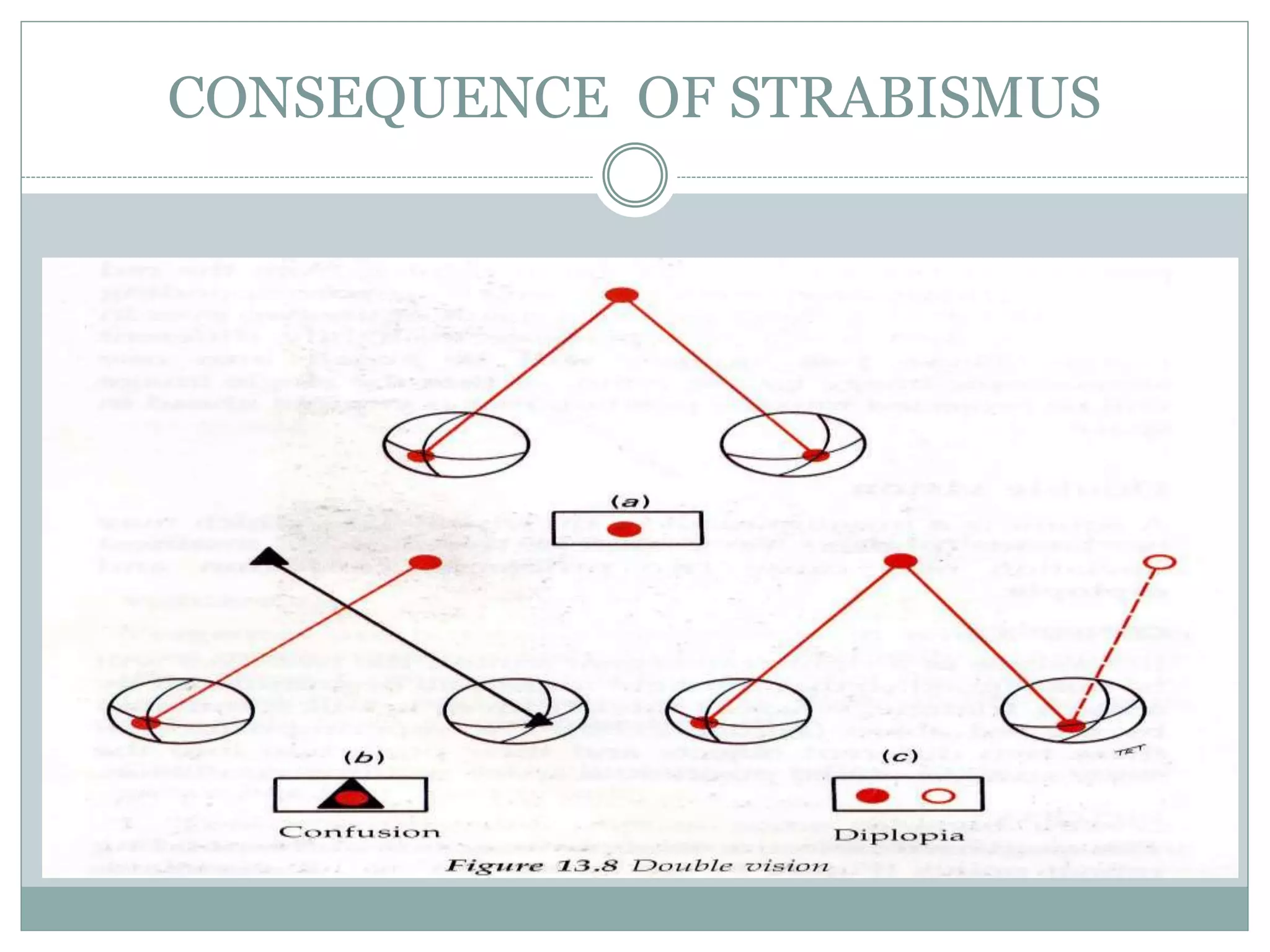 Motor adaptation in paretic and nonparetic strabismus | PPTX