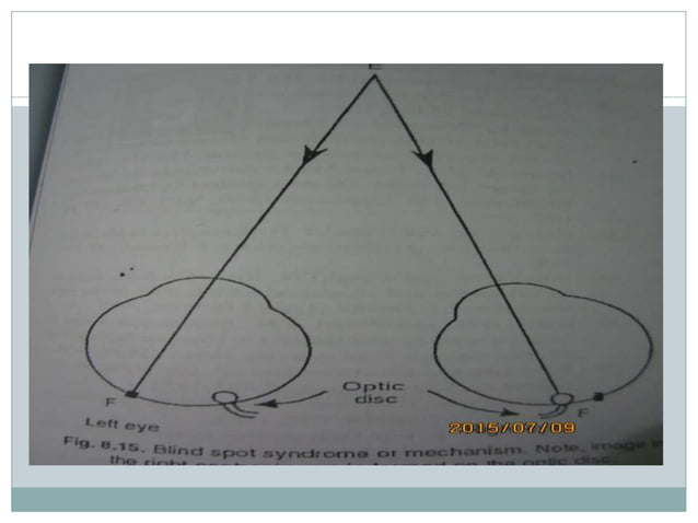 Motor adaptation in paretic and nonparetic strabismus | PPTX | Eye and ...