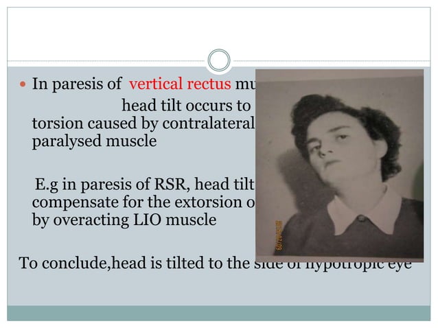 Motor adaptation in paretic and nonparetic strabismus | PPTX | Eye and ...