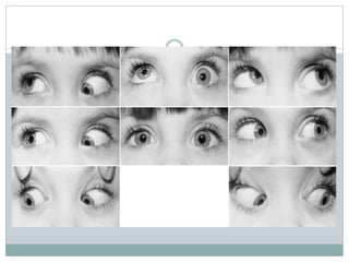 Motor adaptation in paretic and nonparetic strabismus | PPTX