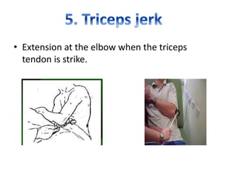 Motor and sensory examination, Examination of reflexes | PPTX