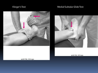 Motor control in ankle instability | PPTX