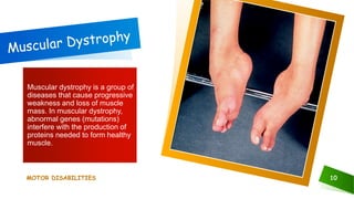 Motor disabilities | PPTX