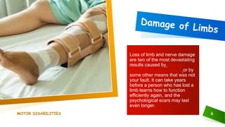 Motor disabilities | PPTX