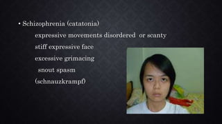 Motor disorders | PPTX