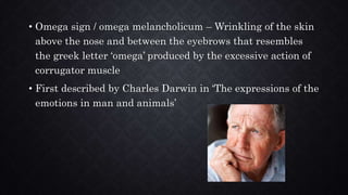 Motor disorders | PPTX