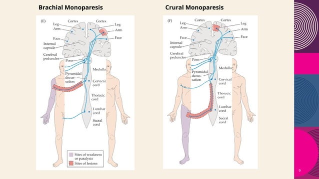 Motor dysfunction Tutorial for Undergraduates.pptx