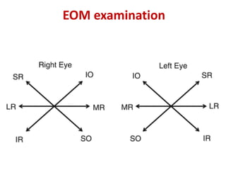 Motor evaluation of squint zoh 2021 part 2 | PPT