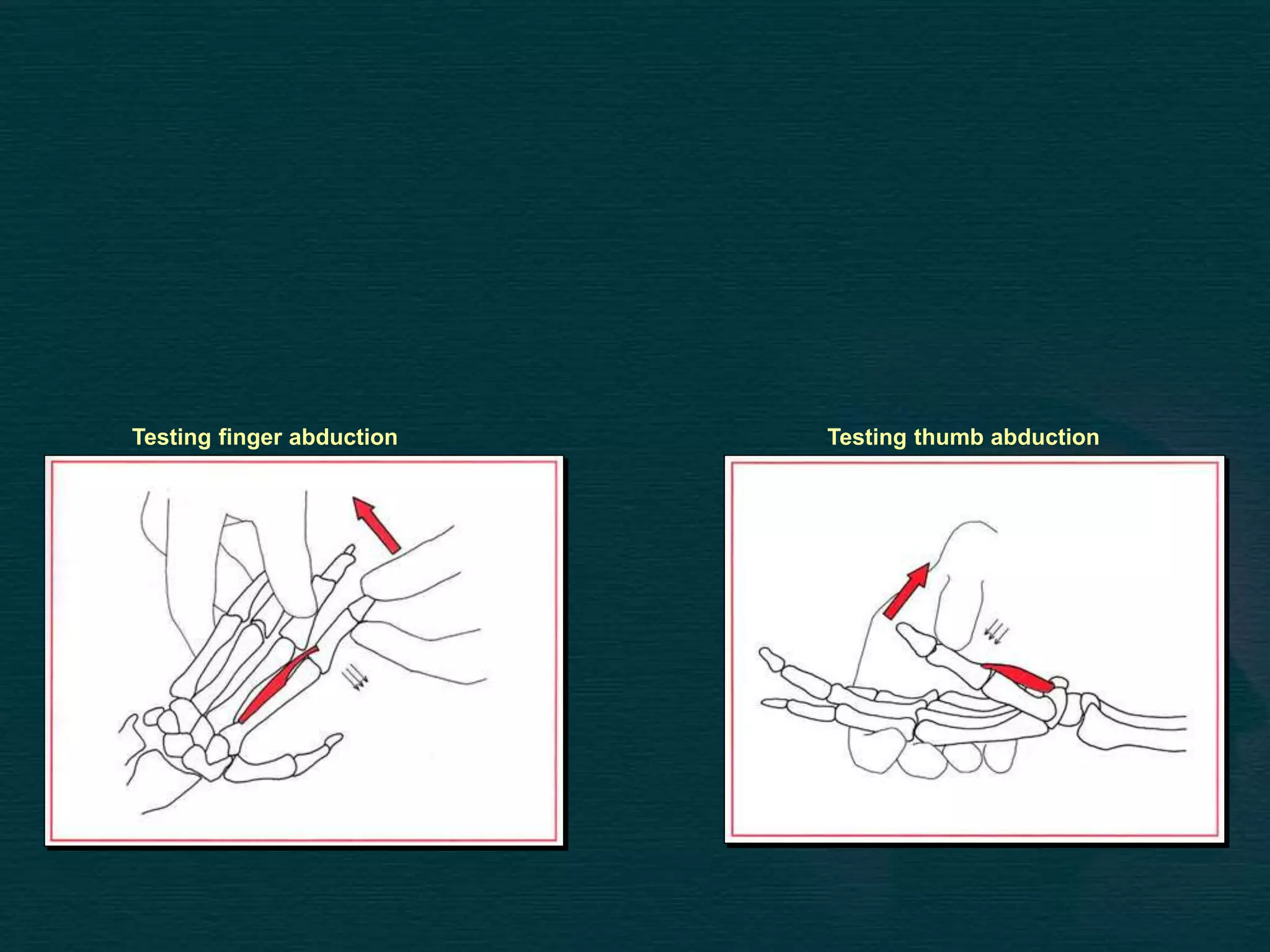 motor Examination-1.ppt