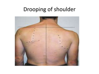 Motor examination of individual muscle | PPTX