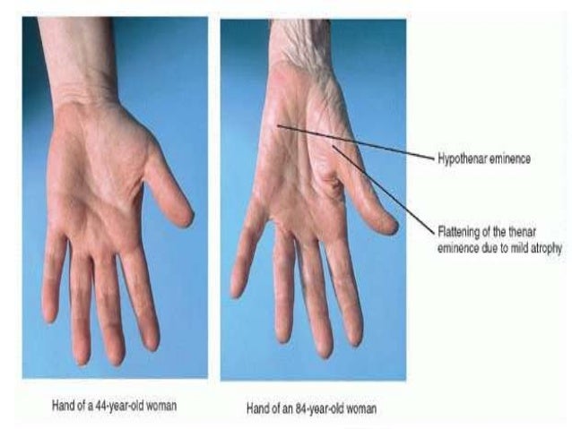 Motor System Examination