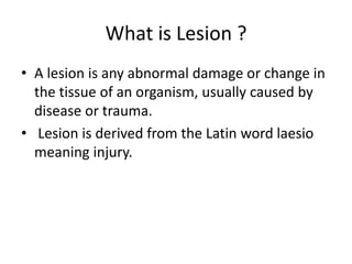 Motor neuron lesions ( UMNL & LMNL ) | PPTX