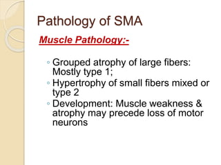 Motor Neuron Disease and PT Mx | PPTX