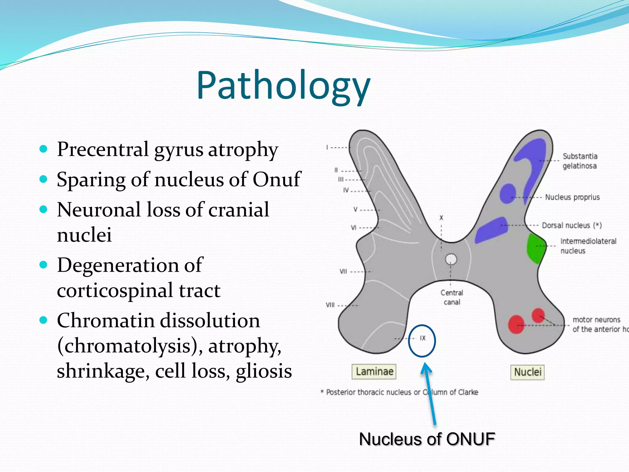 Motor neuron disease - Etiology, Pathogenesis, Clinical Features ...