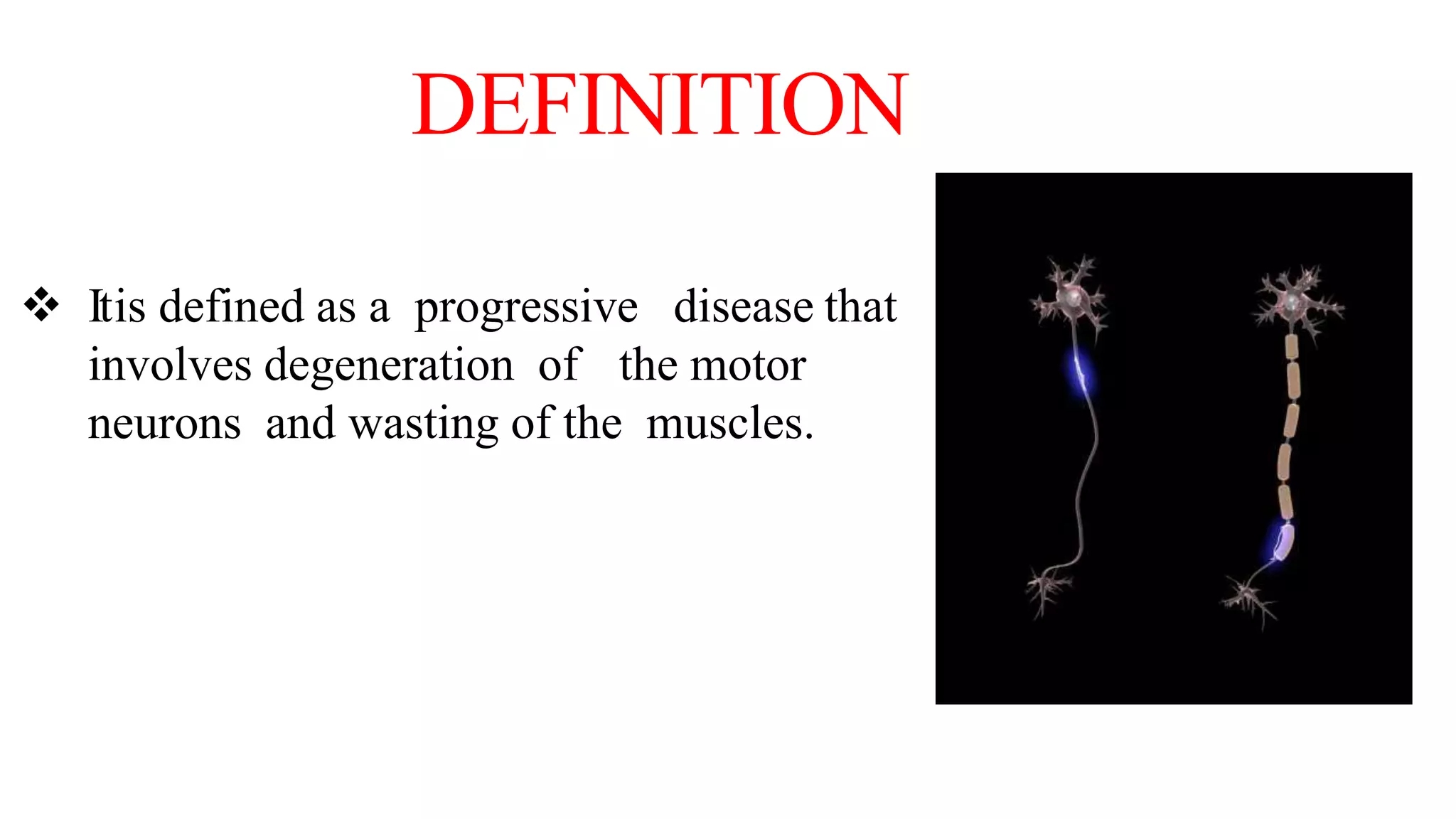 MOTOR NEURON DISEASE.pptx