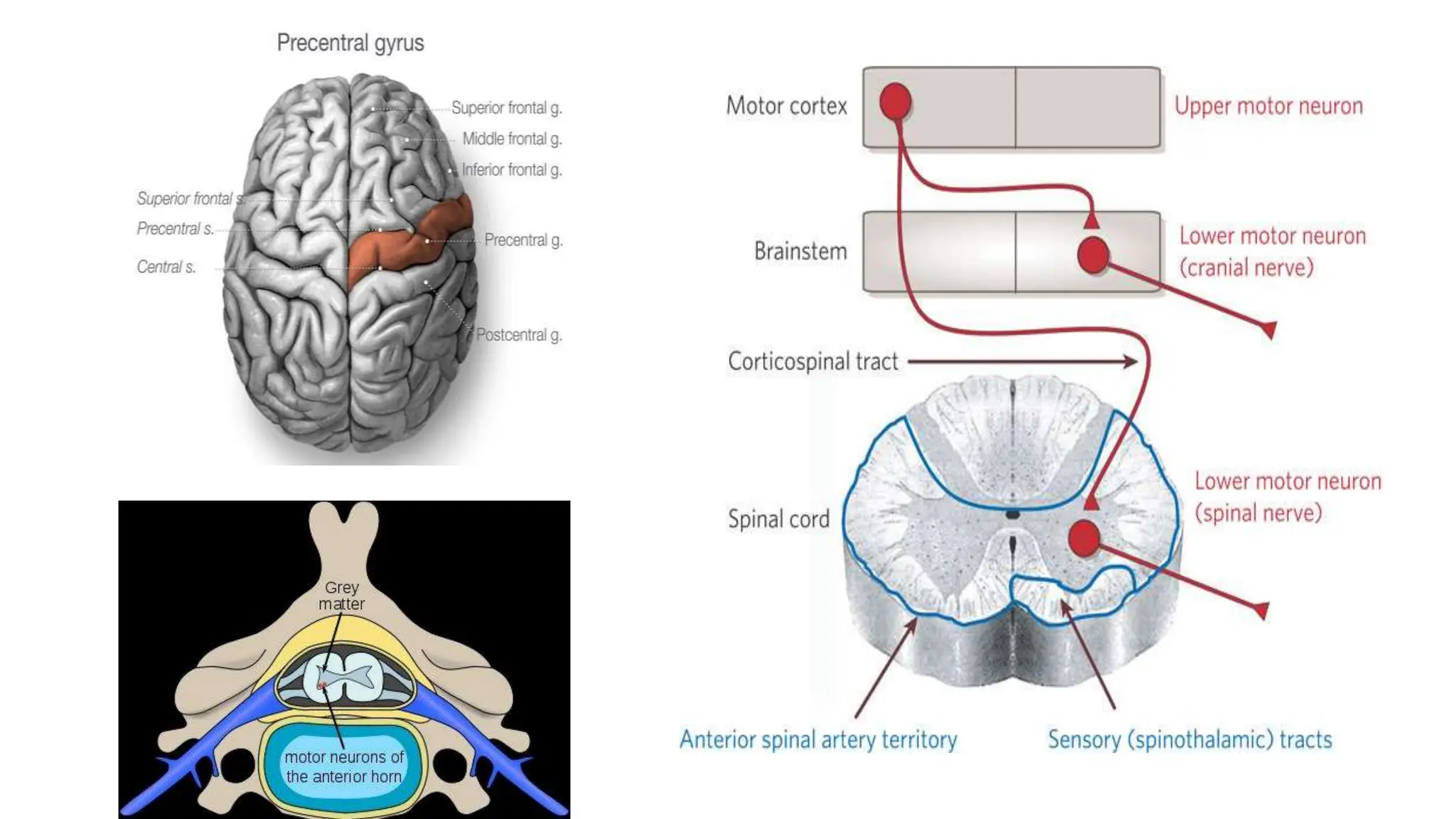 MOTOR NEURON DISEASE - Presentation Neuro | PPT