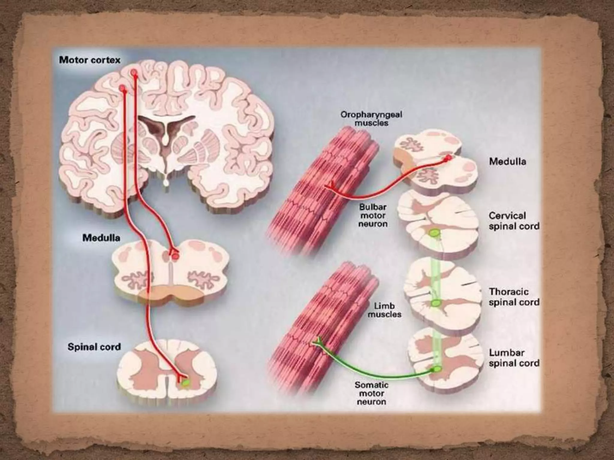 Motorneuron diseases | PPT