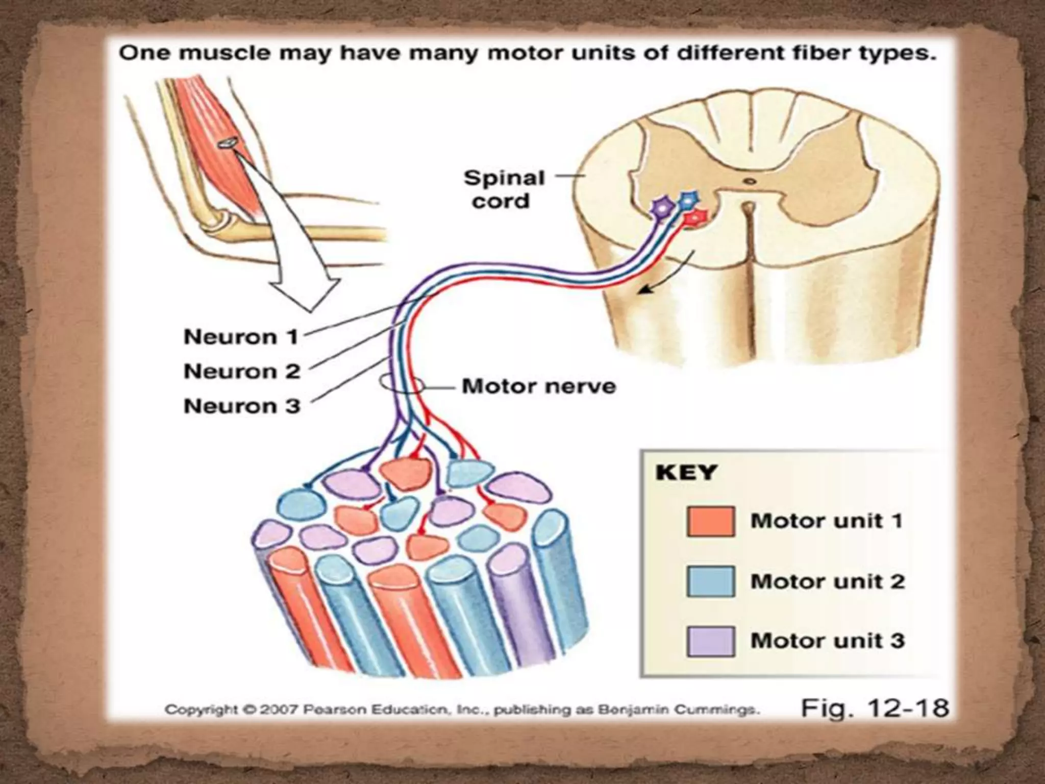 Motorneuron diseases | PPT