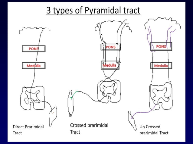 Pyramida and extrapyramidal tracts | PPTX | Death, Injury, or Military ...