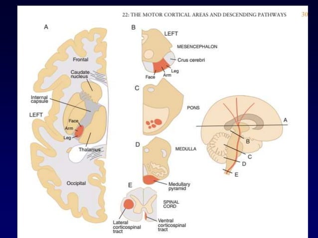Pyramida and extrapyramidal tracts | PPTX | Death, Injury, or Military ...