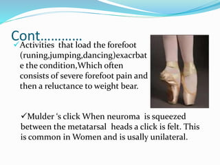Motorn's neuroma | PPTX