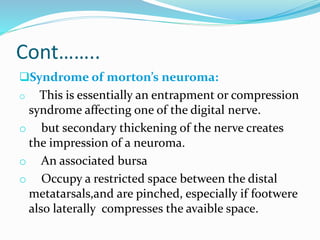 Motorn's neuroma | PPTX