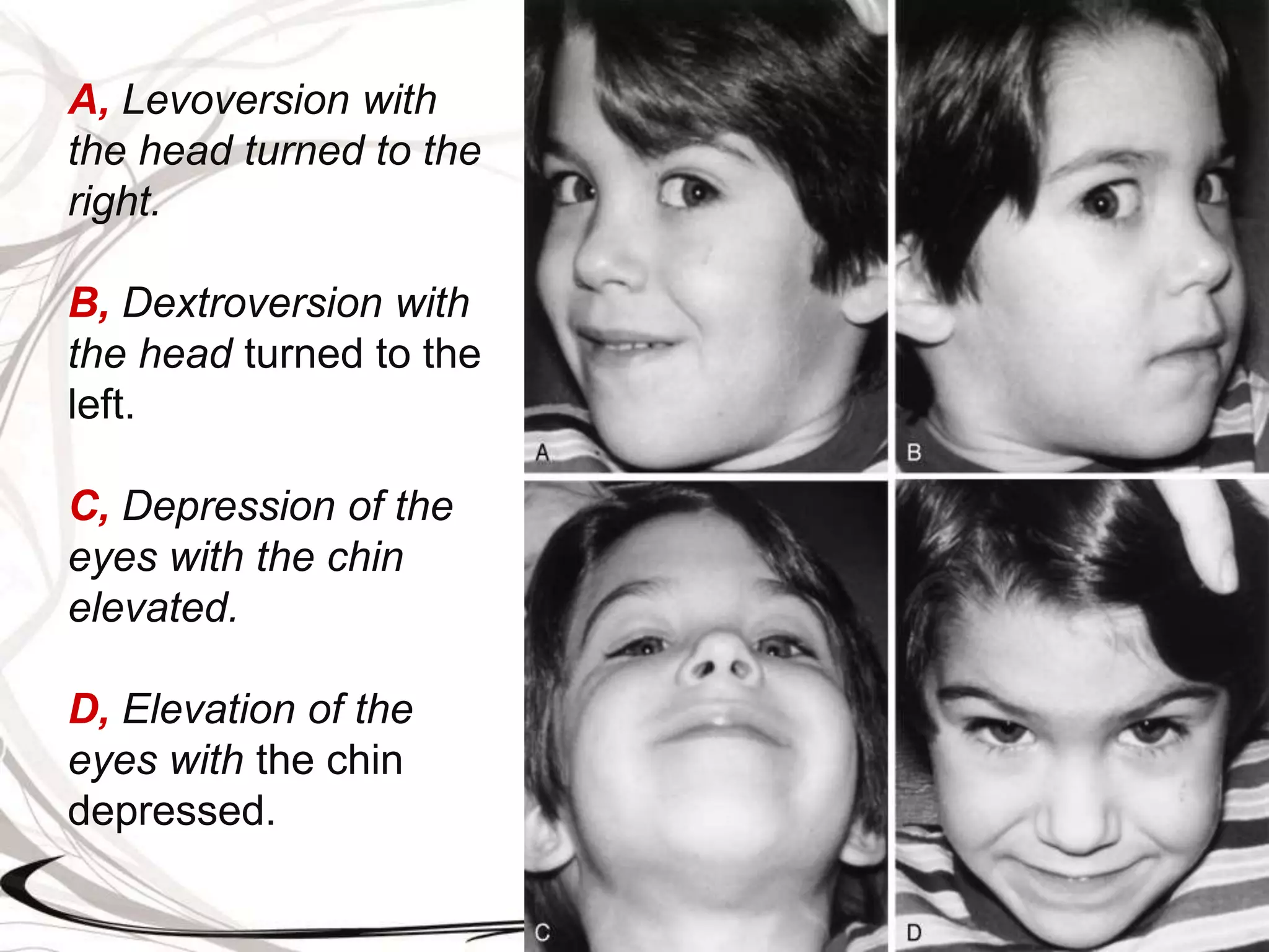 Motor physiology of the eye | PPTX