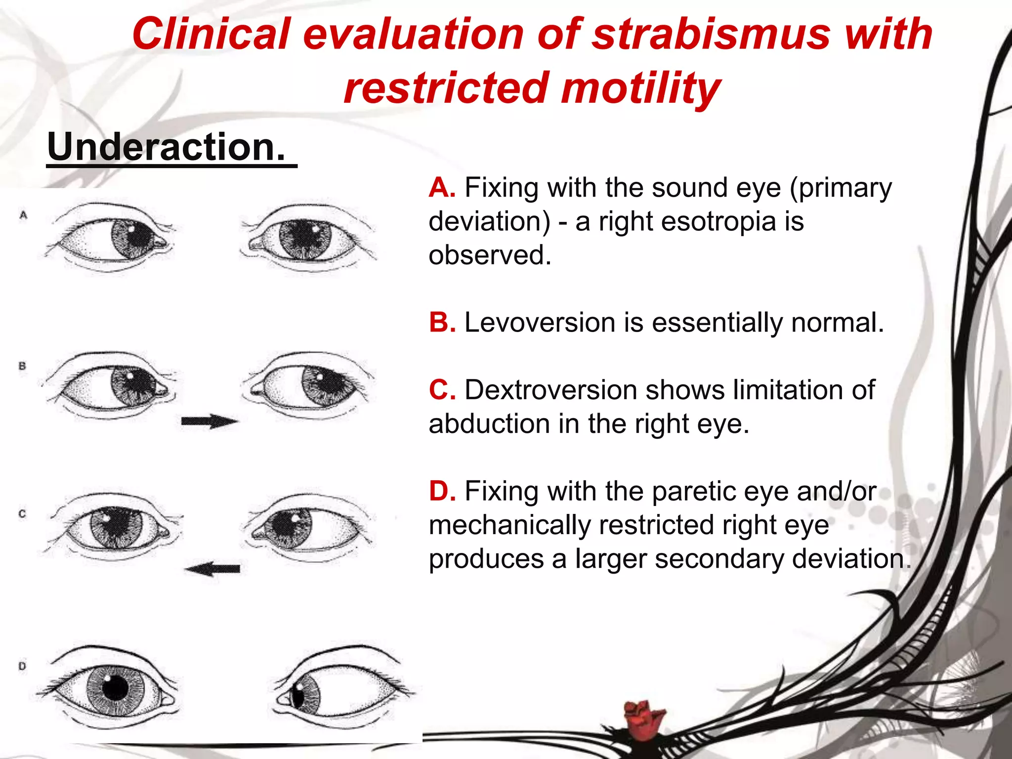 Motor physiology of the eye | PPTX