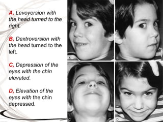 Motor physiology of the eye | PPTX