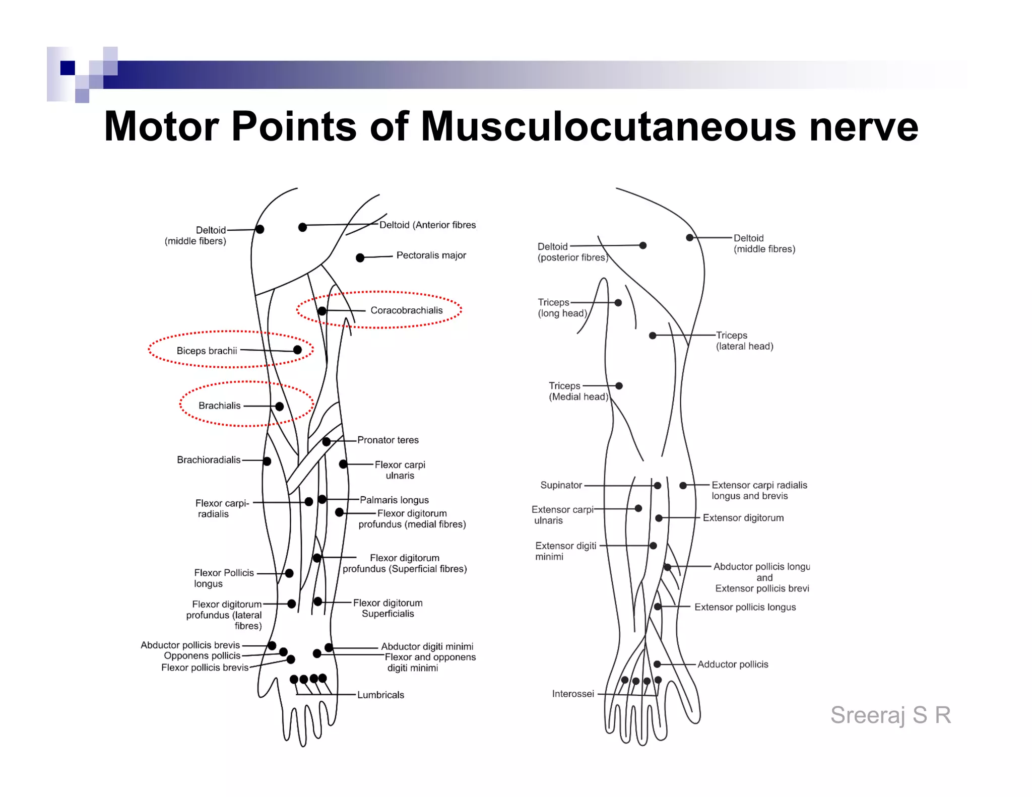 Motor Points Nerve Injuries.pdf