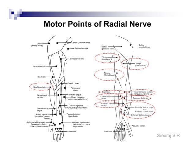Motor Points Nerve Injuries.pdf | First Aid | Injuries