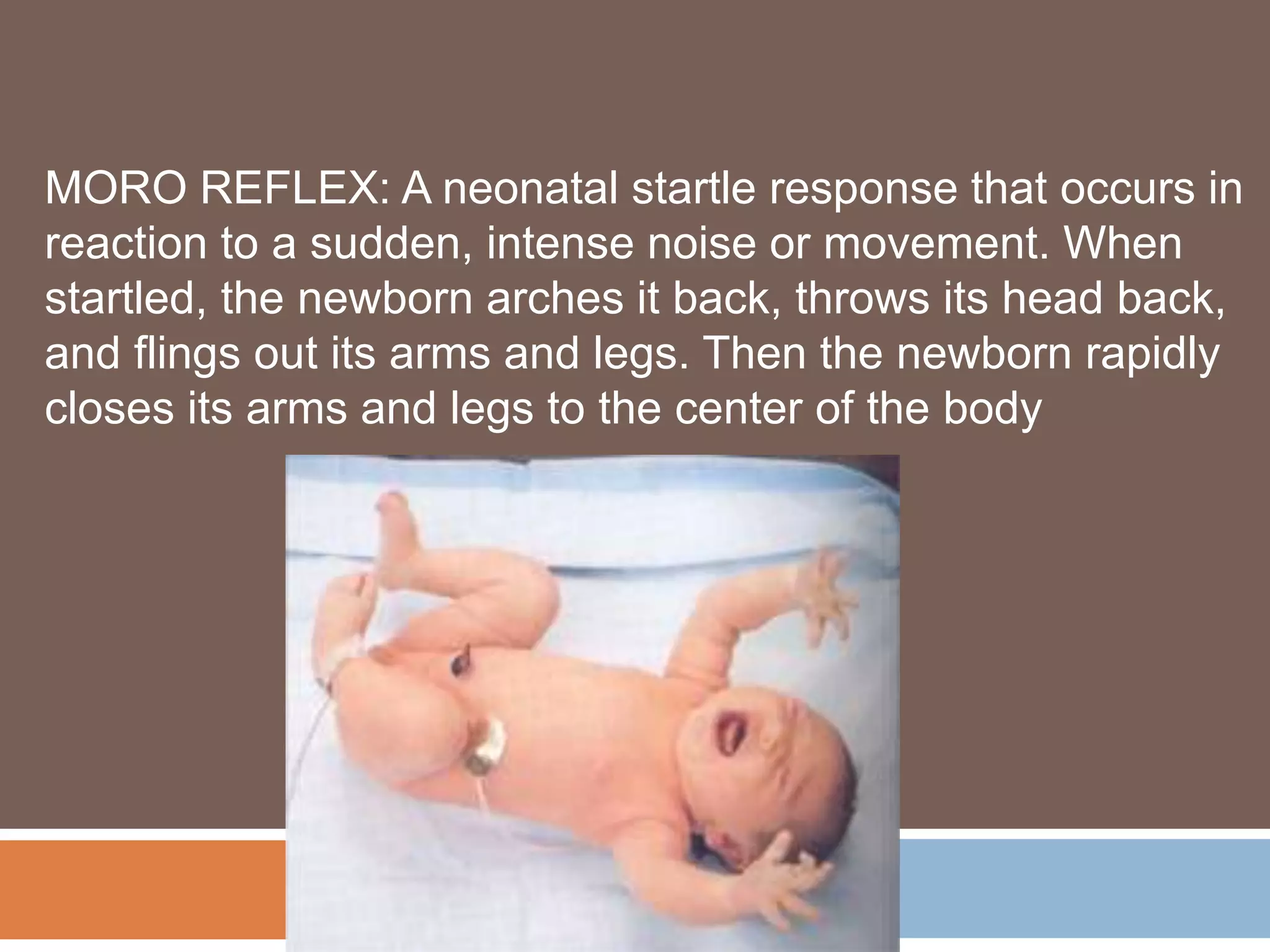 Motor skills | PPTX