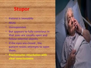 Motor symptoms and sign in psychiatry | PPT
